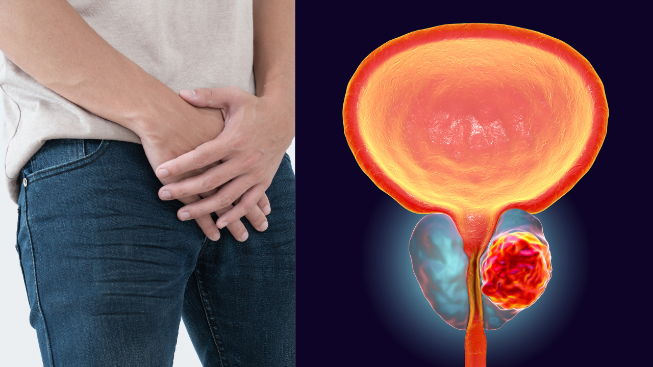 The Ultimate Guide to a Healthy Prostate - The Man Nexus